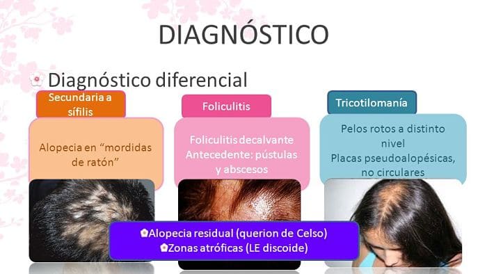 Querión De Celso: Características, Causas, Síntomas, Tratamiento